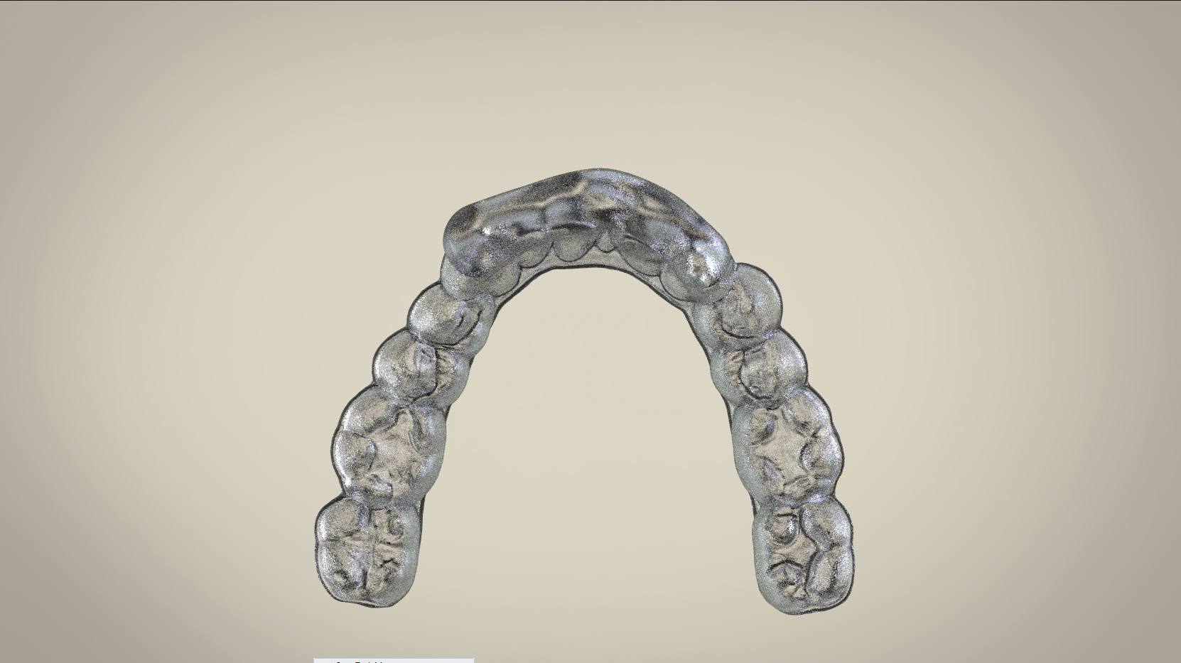 STL file Ortho Superior Repositioner Splint 💤 (OBJ and 3MF)・3D ...
