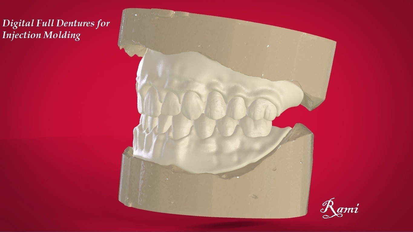 STL file Digital Full Dentures for 3D Printing, Milling & Injection ...