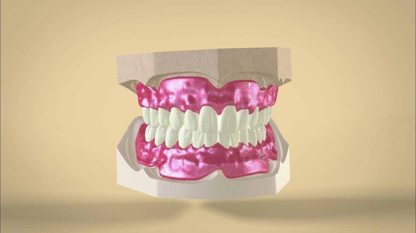 STL file Digital Full Dentures 🦷 ・3D printer model to download・Cults