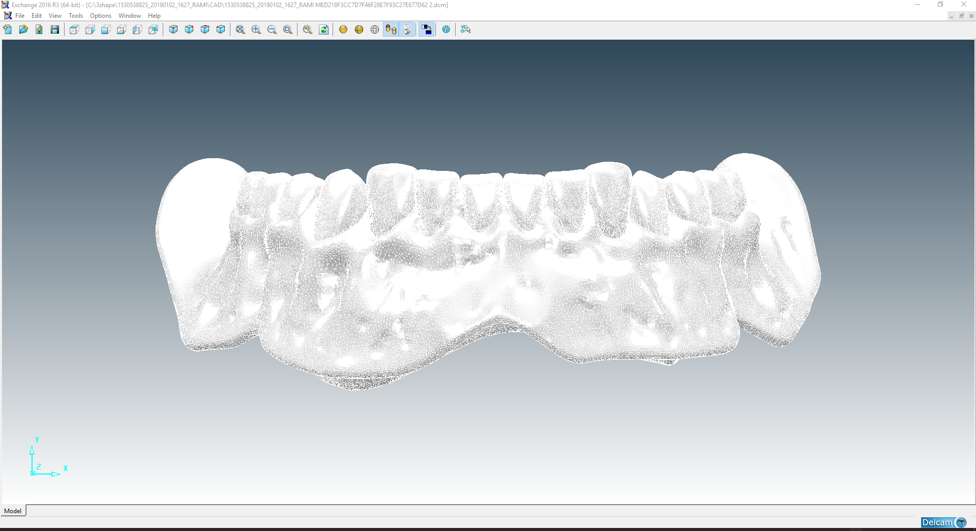 STL file Digital Try-in Full Dentures for Injection Molding ⚕️ (OBJ)・3D ...