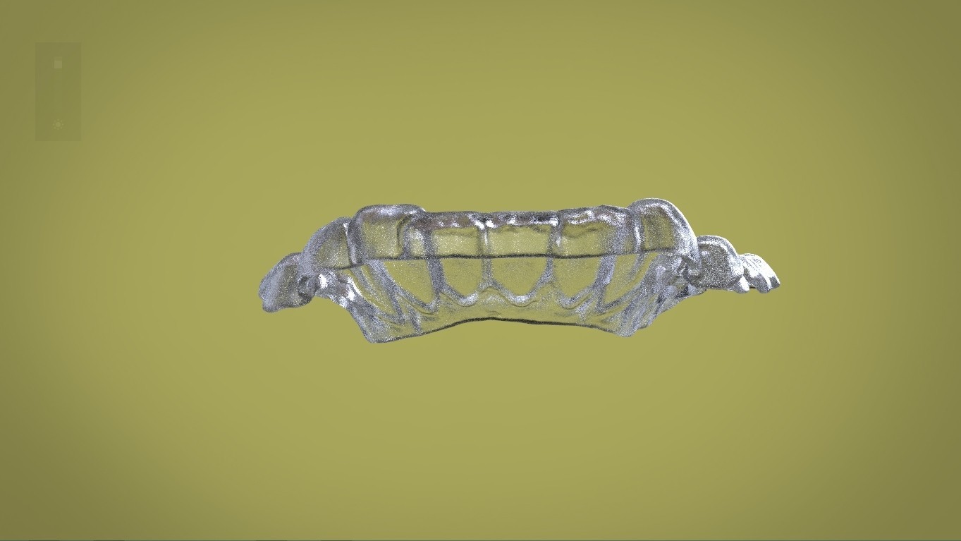STL file Digital Dental B Splints 🦷 (OBJ)・3D printing model to download ...