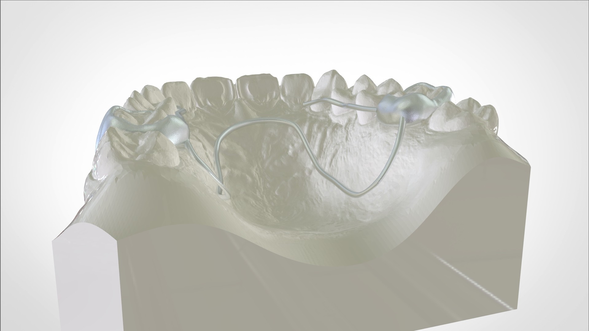 STL file Digital Porter Appliance 🎨 (OBJ and 3MF)・3D printer model to ...