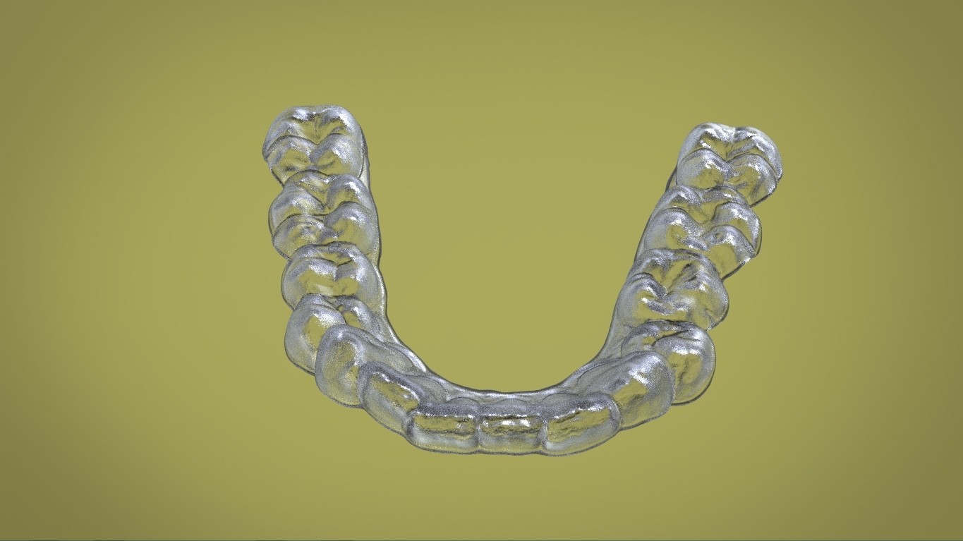 STL file Digital Dental B Splints 🦷 (OBJ)・3D printing model to download ...