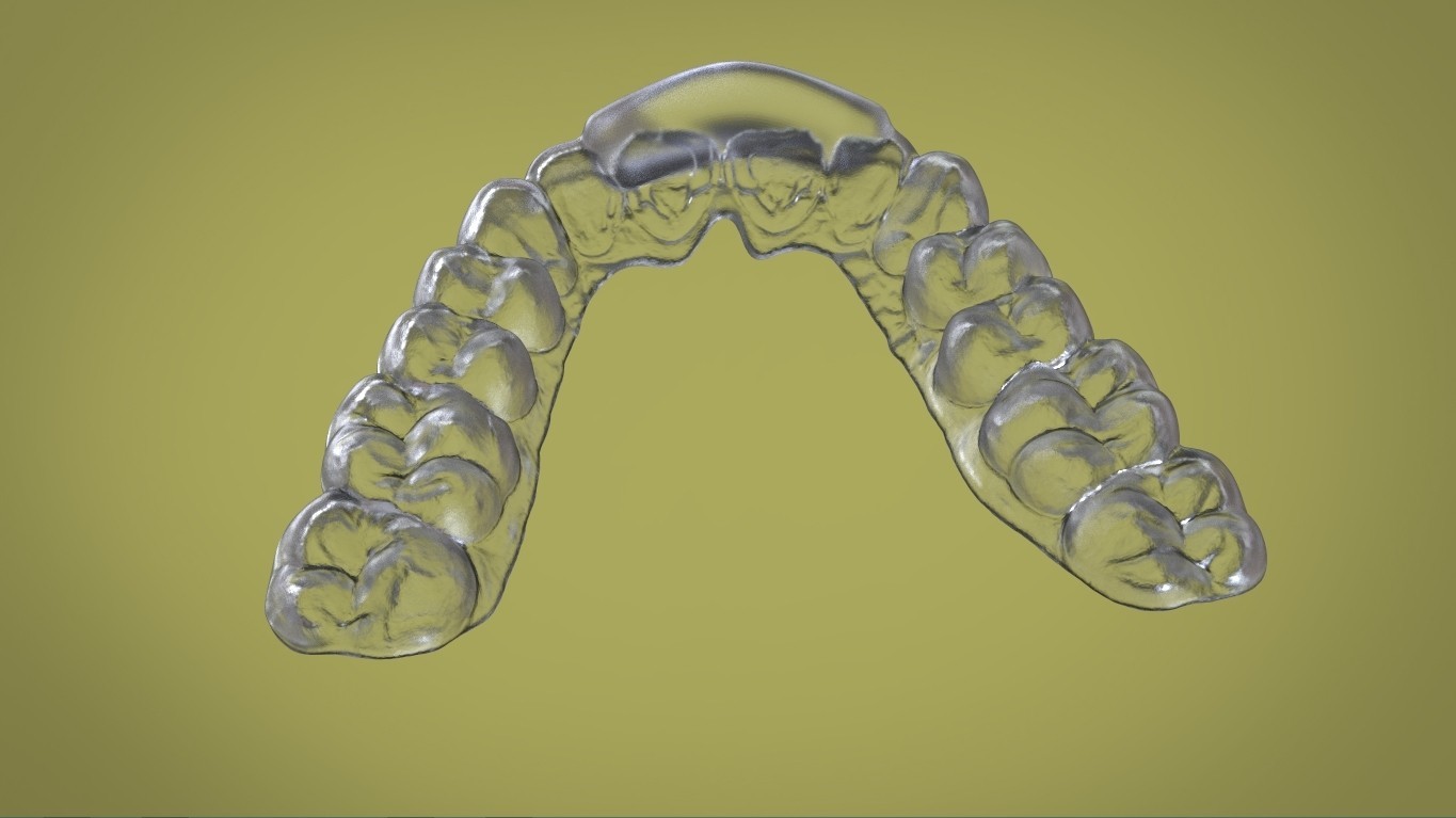STL file Digital Dental B Splints 🦷 (OBJ)・3D printing model to download ...