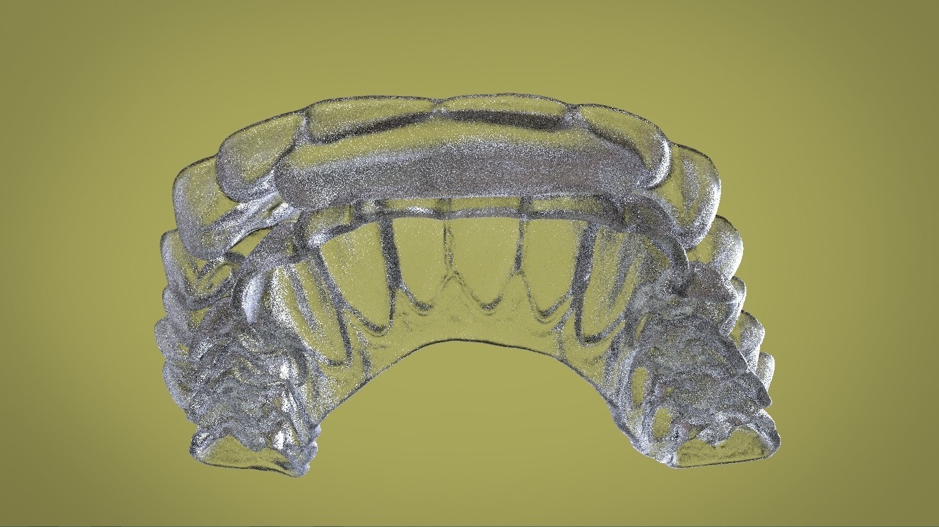 STL file Digital Dental B Splints 🦷 (OBJ)・3D printing model to download ...