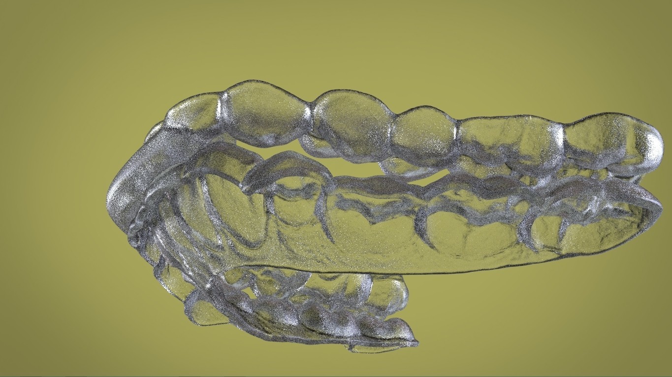 STL file Digital Dental B Splints 🦷 (OBJ)・3D printing model to download ...
