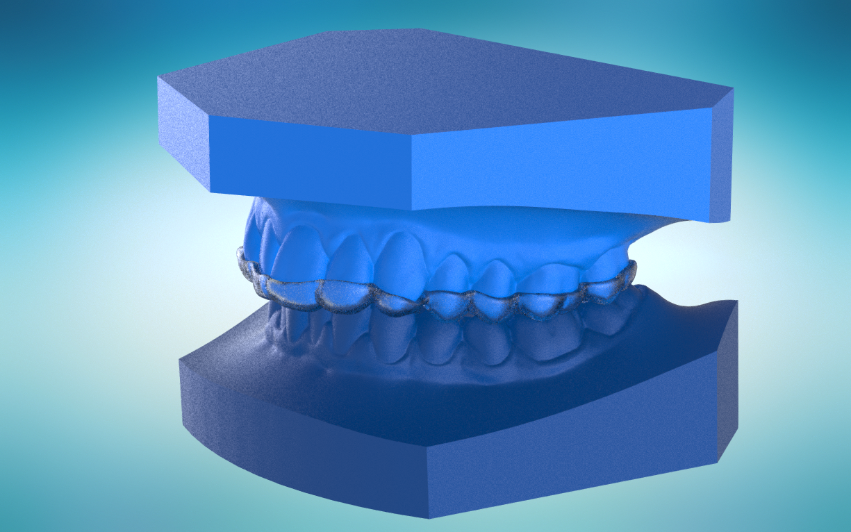 Archivo STL Férula de reposicionamiento Digital Ortho Anterior 🦷 (OBJ ...