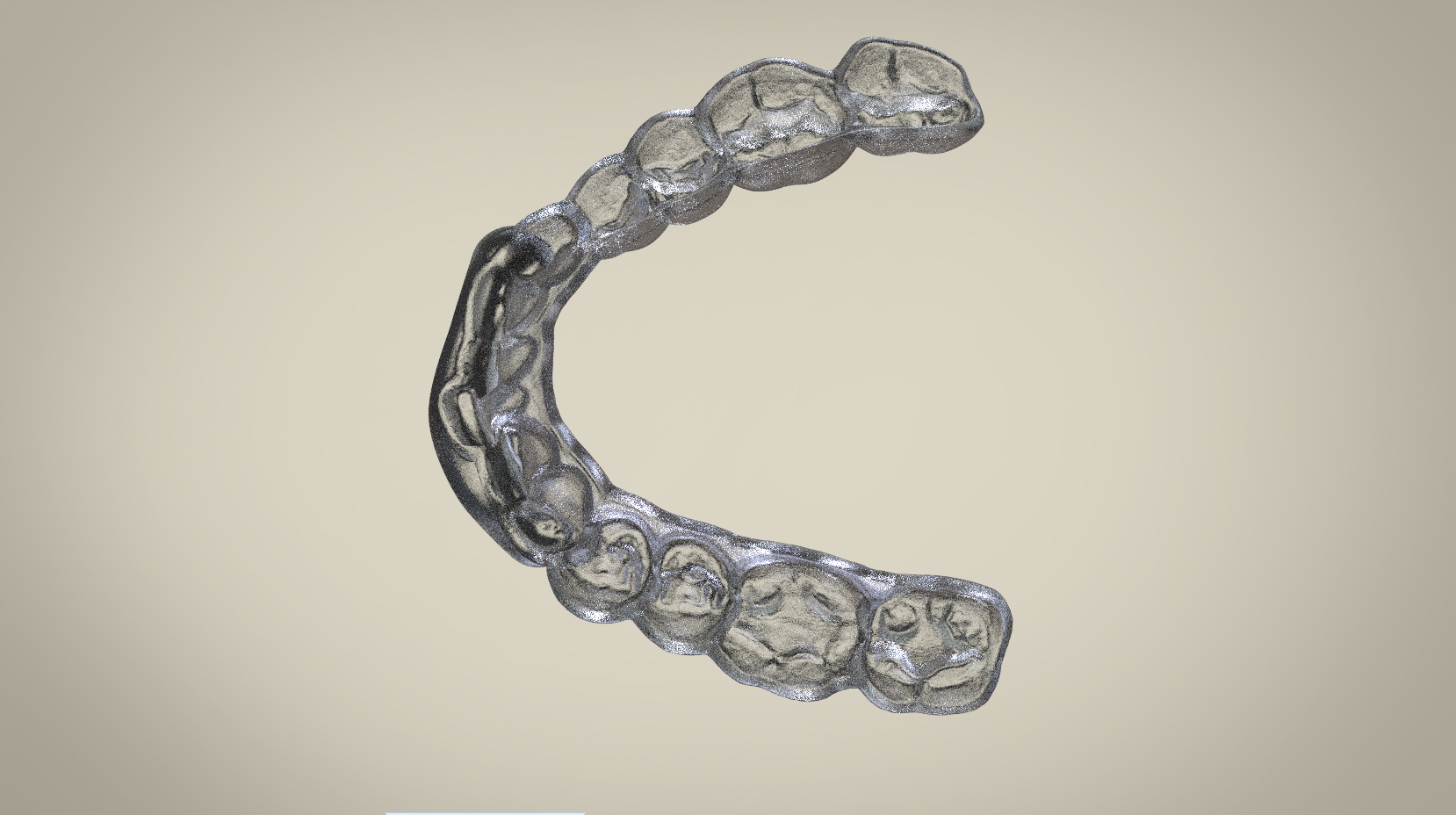 STL file Ortho Superior Repositioner Splint 💤 (OBJ and 3MF)・3D ...