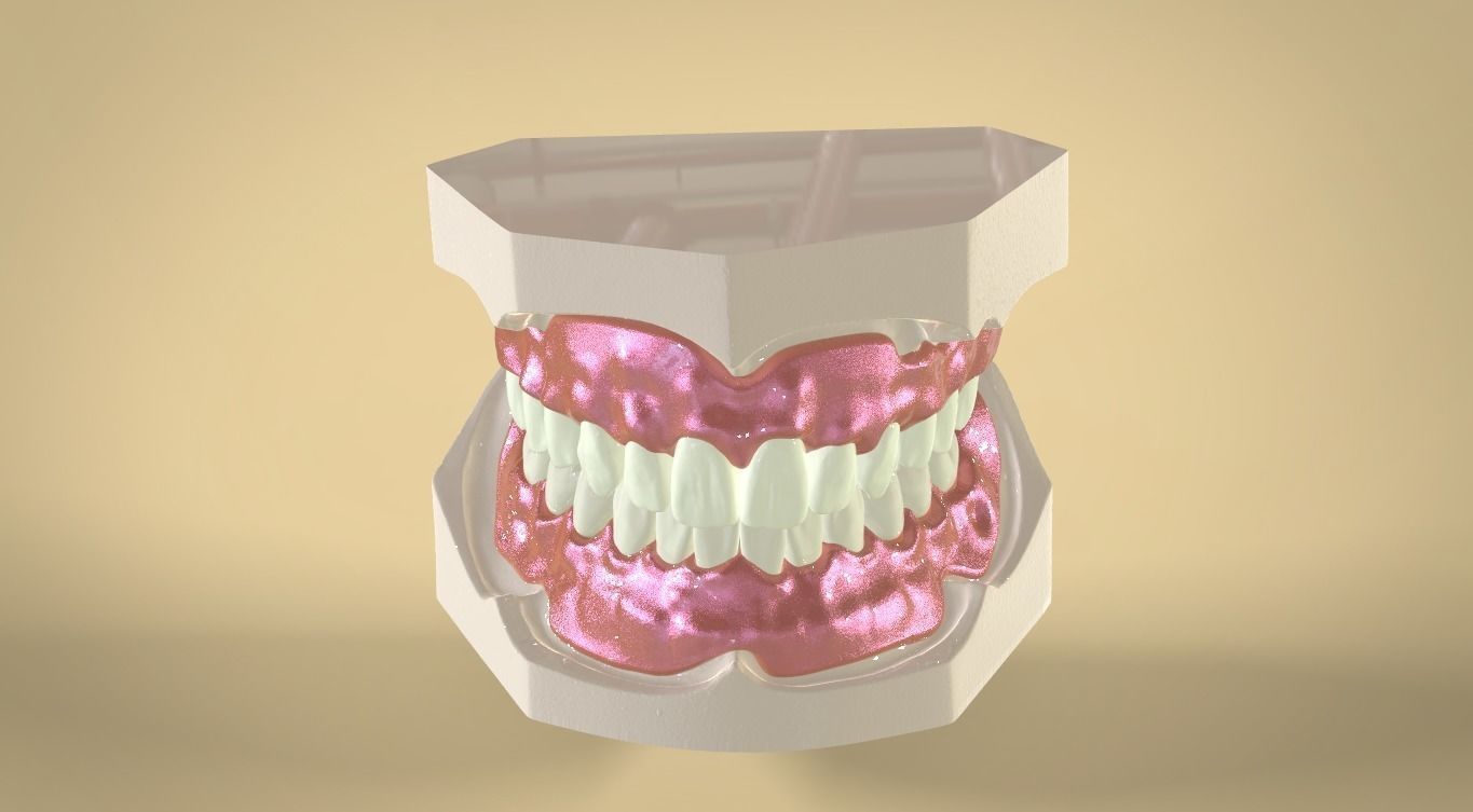 STL file Digital Full Dentures 🦷 ・3D printer model to download・Cults