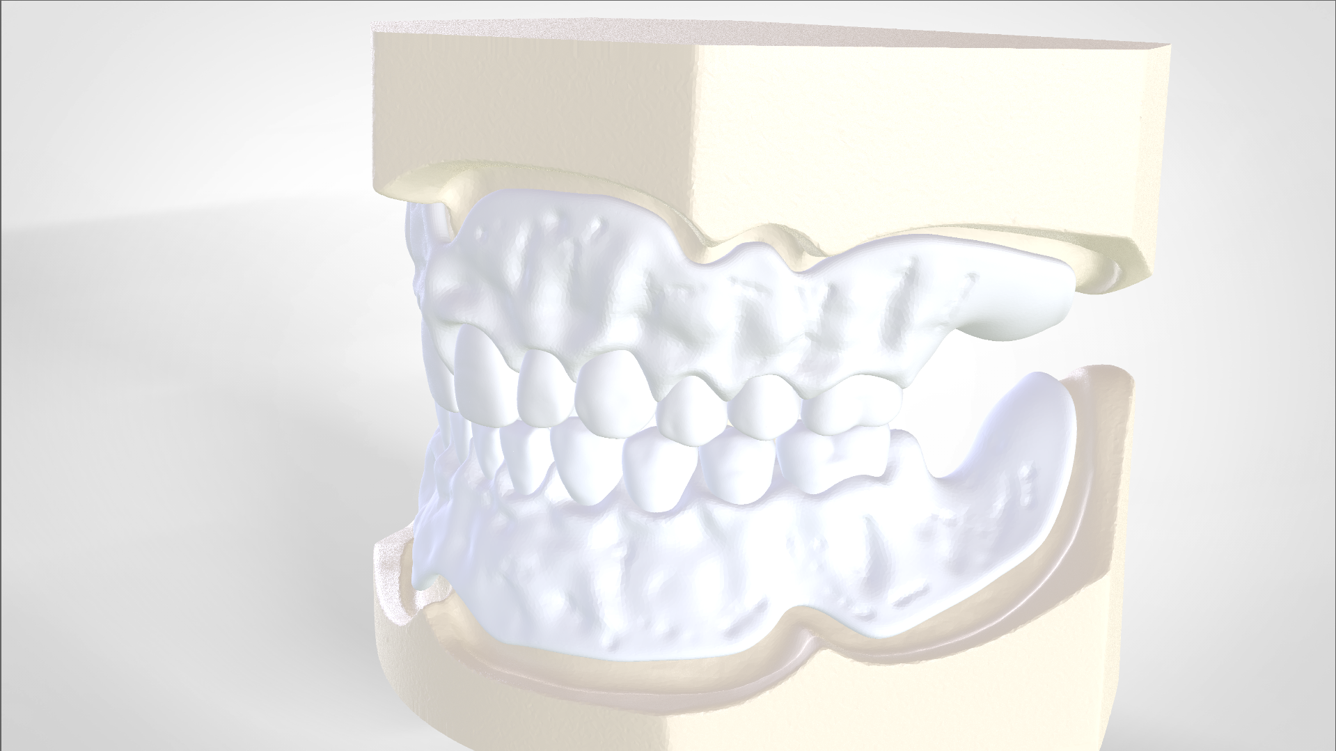 STL file Digital Try-in Full Dentures for Injection Molding ⚕️ (OBJ)・3D ...