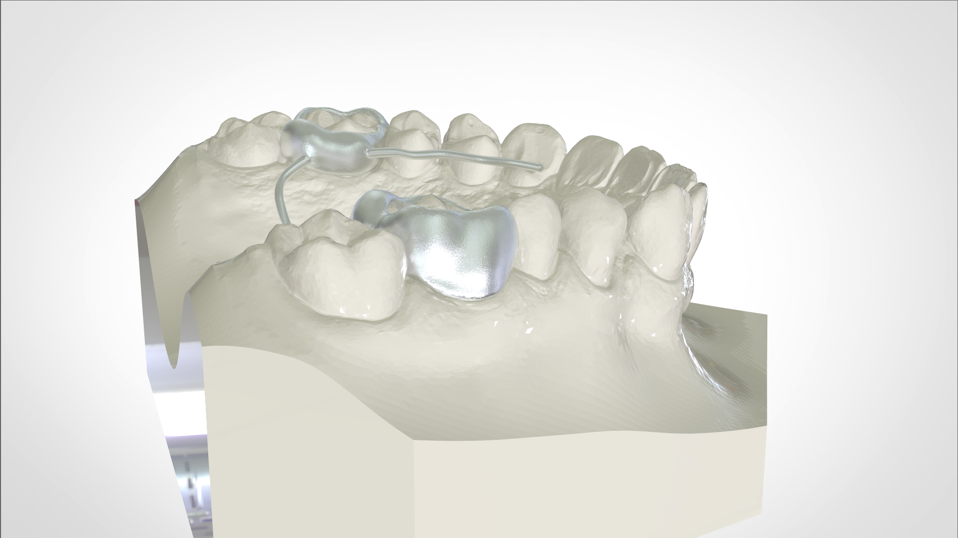 STL file Digital Porter Appliance 🎨 (OBJ and 3MF)・3D printer model to ...