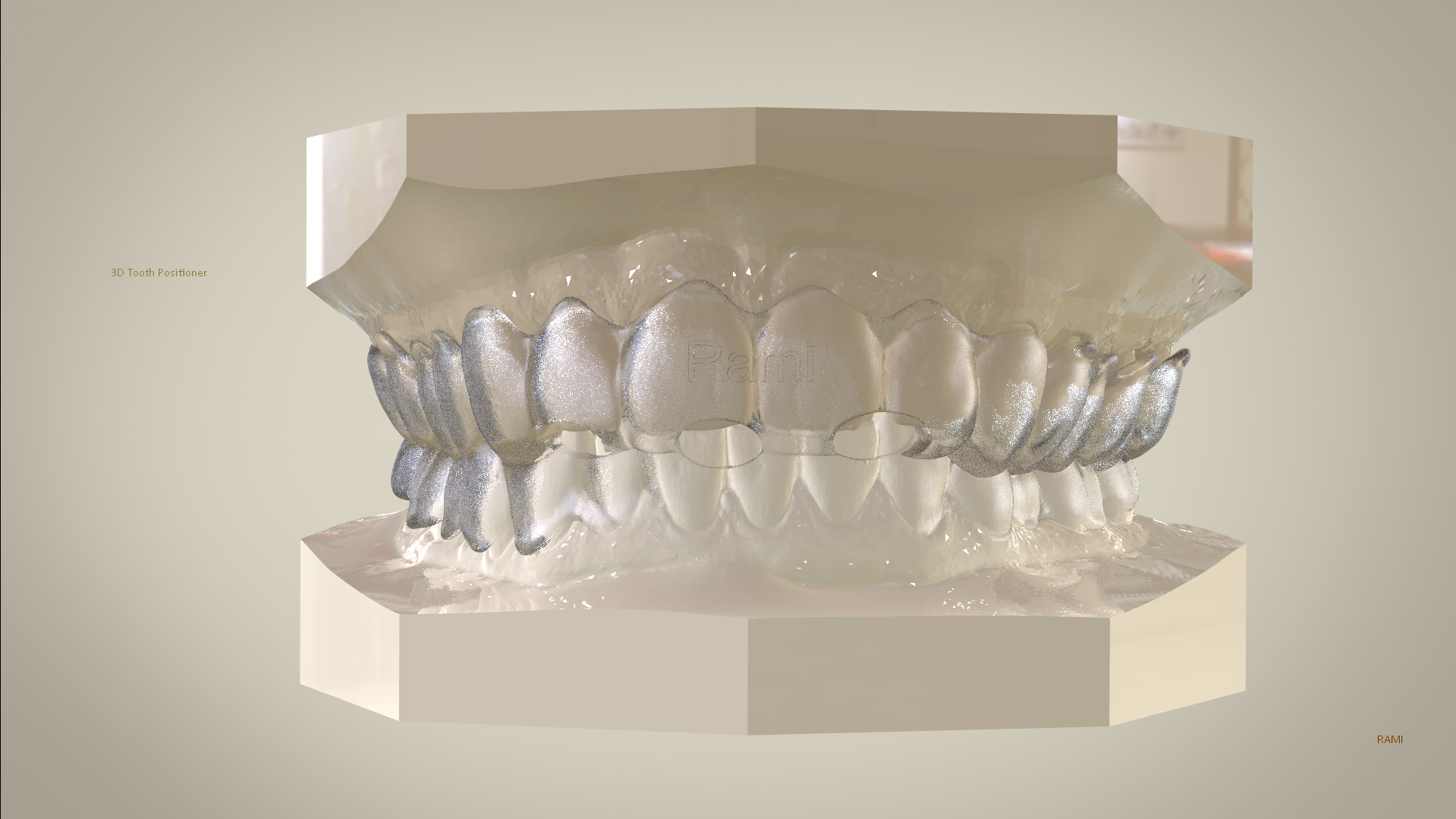 🦷 Digitales Zahnstellungsgerät・ STL Datei für ・Cults
