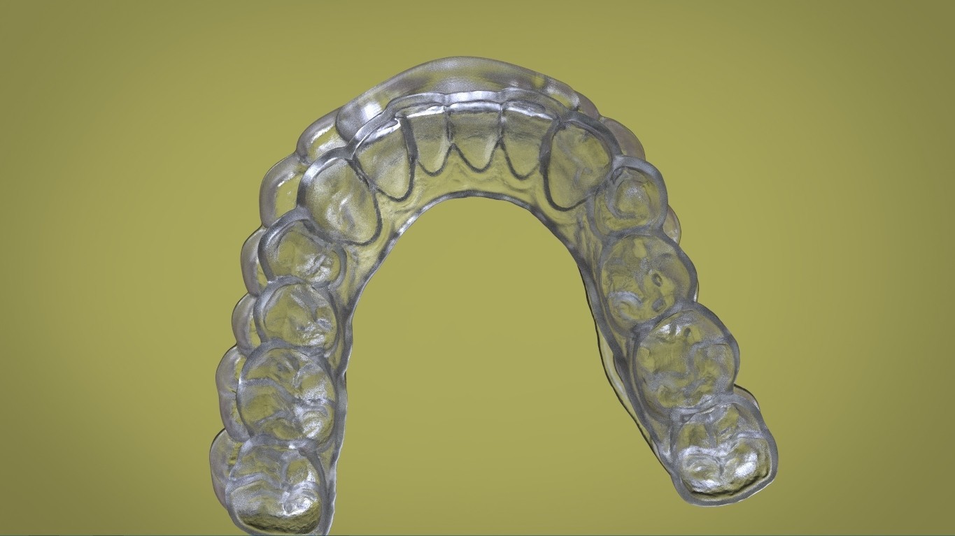 STL file Digital Dental B Splints 🦷 (OBJ)・3D printing model to download ...