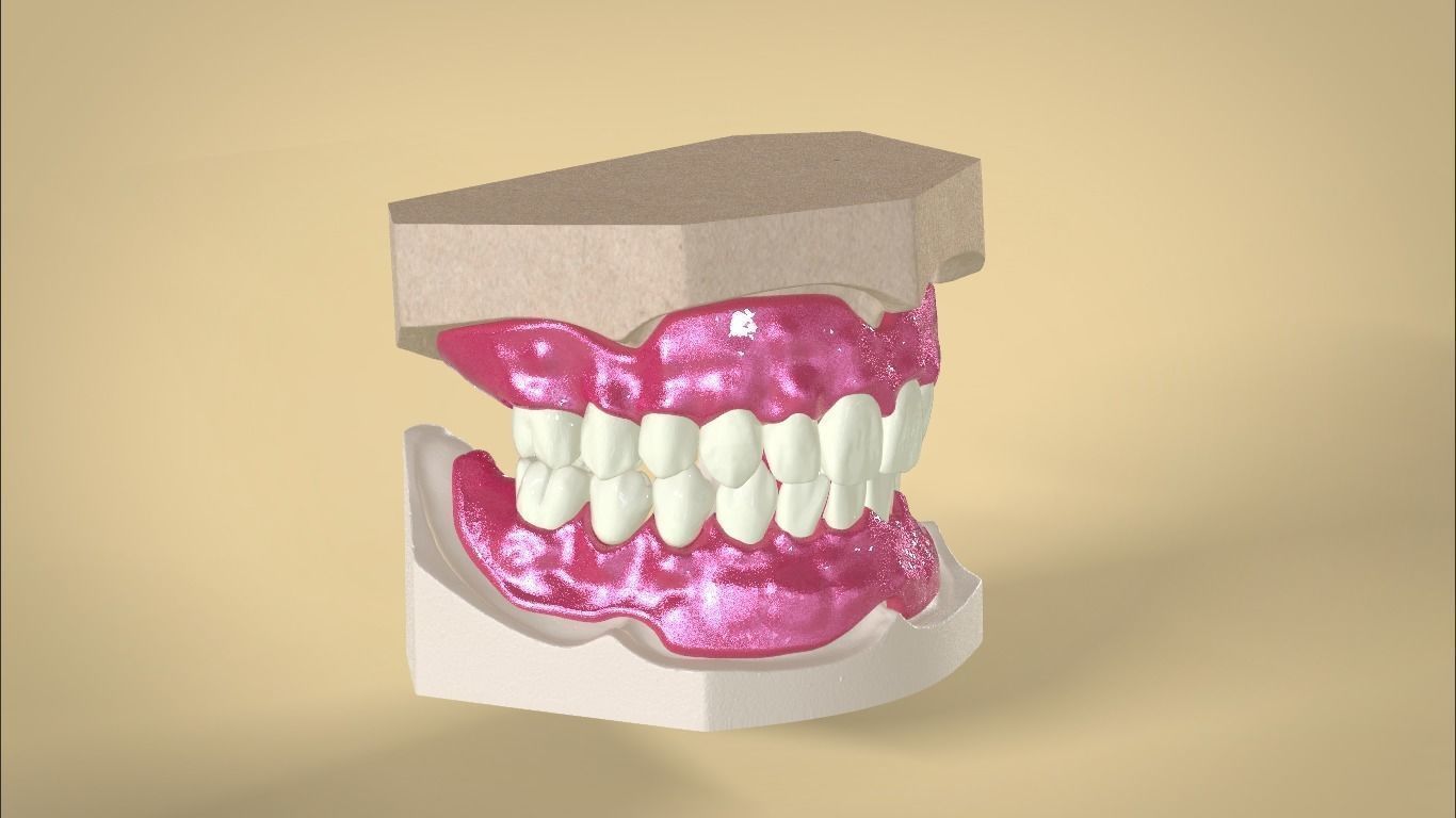 STL file Digital Full Dentures 🦷 ・3D printer model to download・Cults