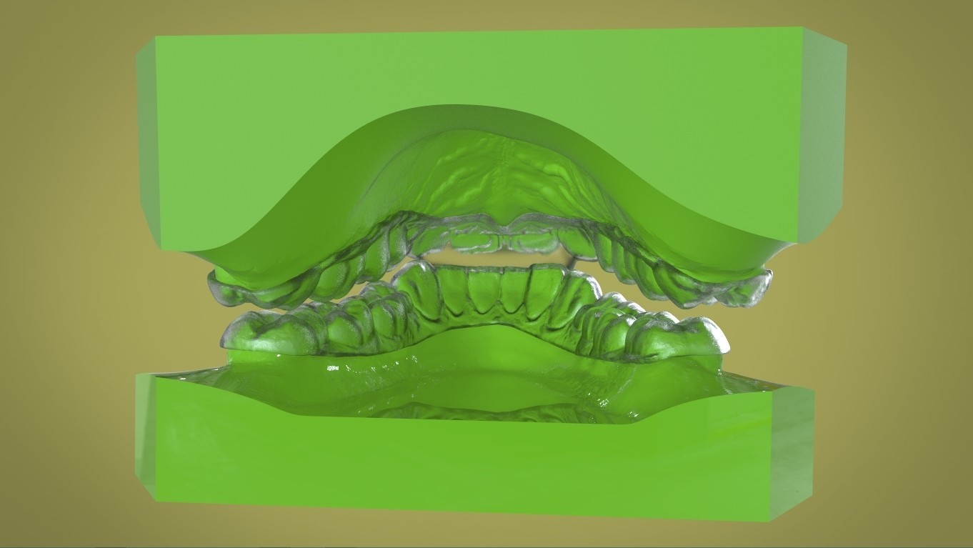 STL file Digital Dental B Splints 💤 (OBJ and 3MF)・3D printing model to ...