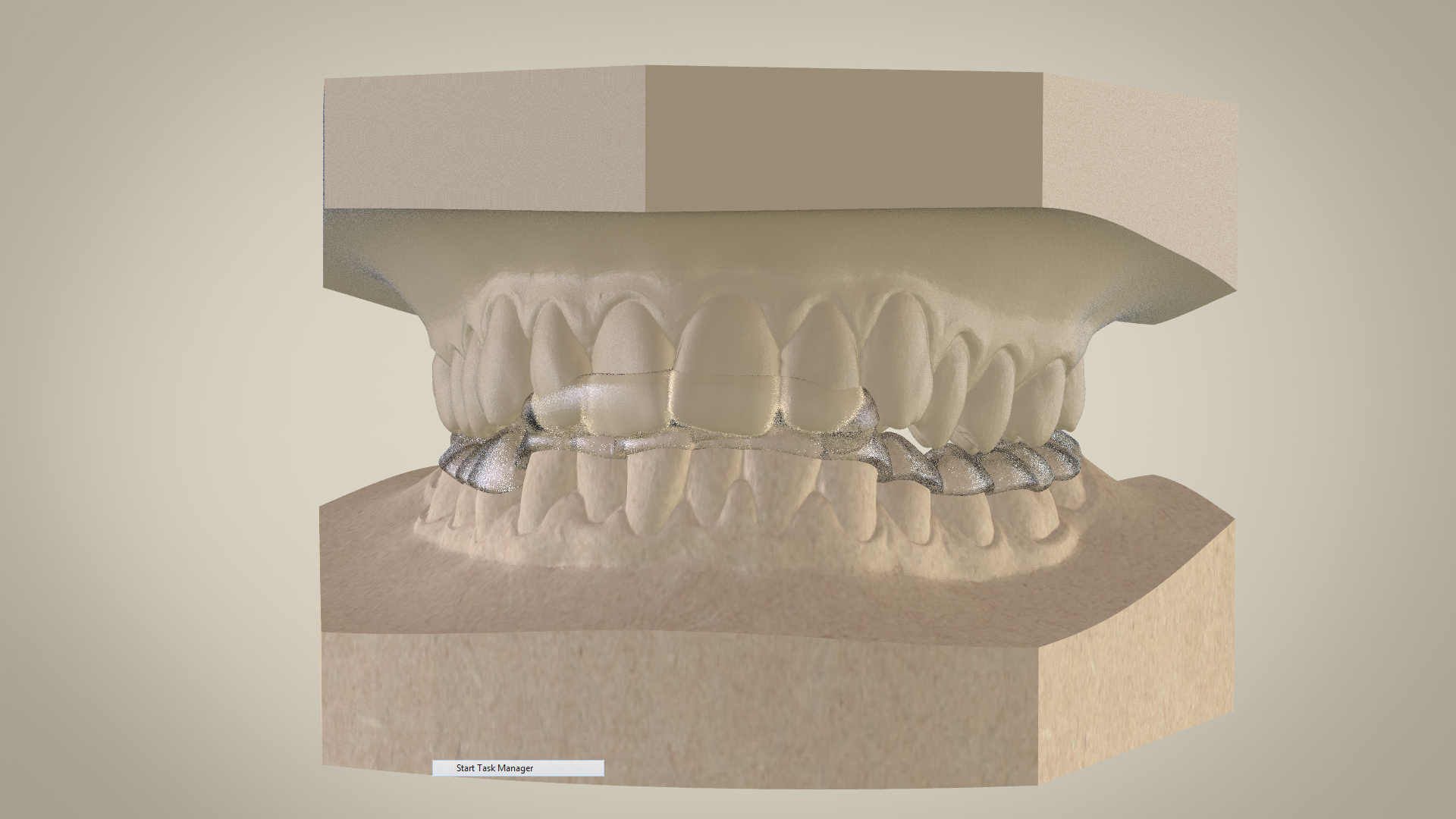 STL file Ortho Superior Repositioner Splint 💤 (OBJ and 3MF)・3D ...