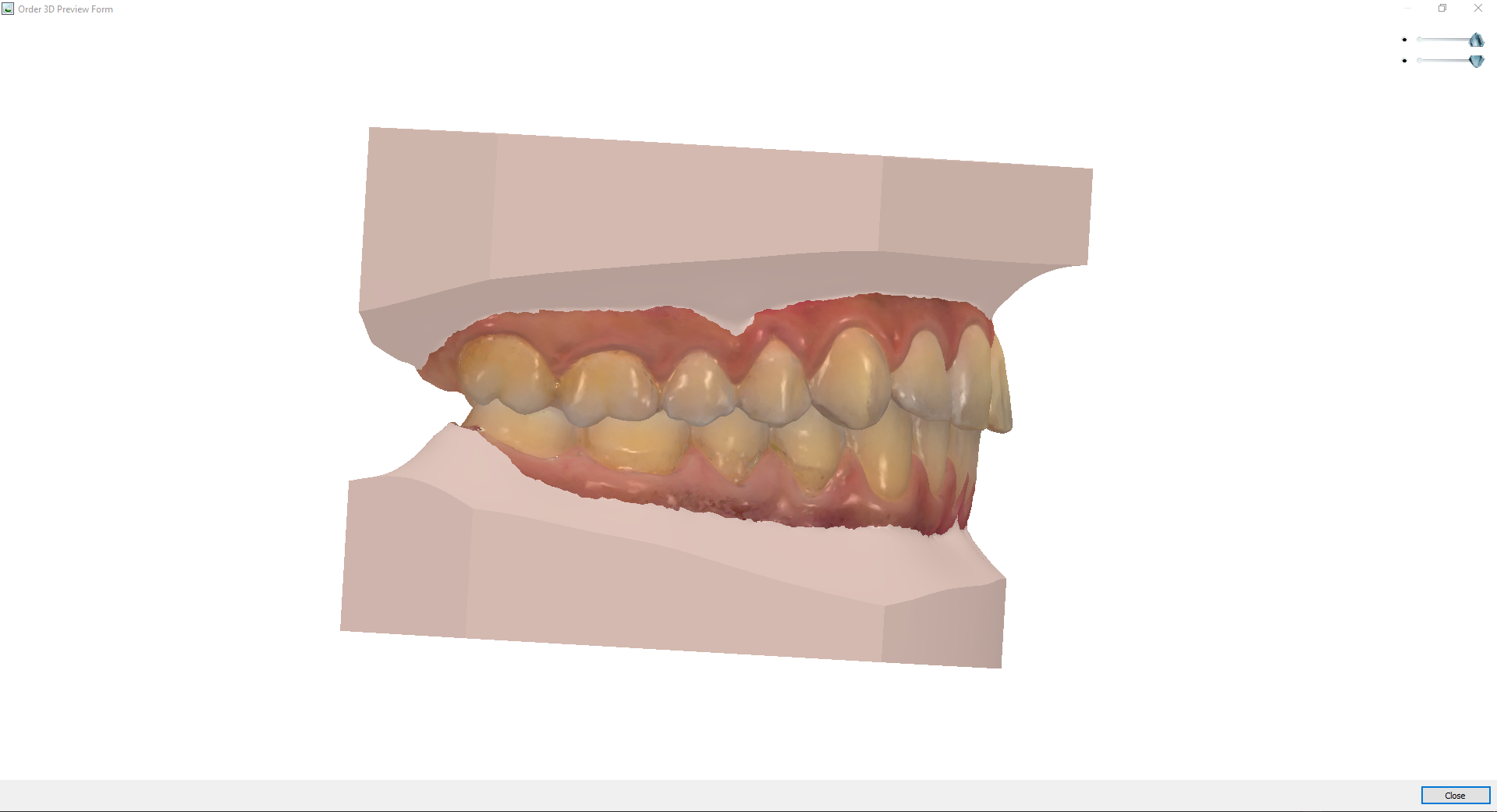 STL file Digital ABO Planning Study Models 🧑‍🏫 (OBJ)・3D printable model ...