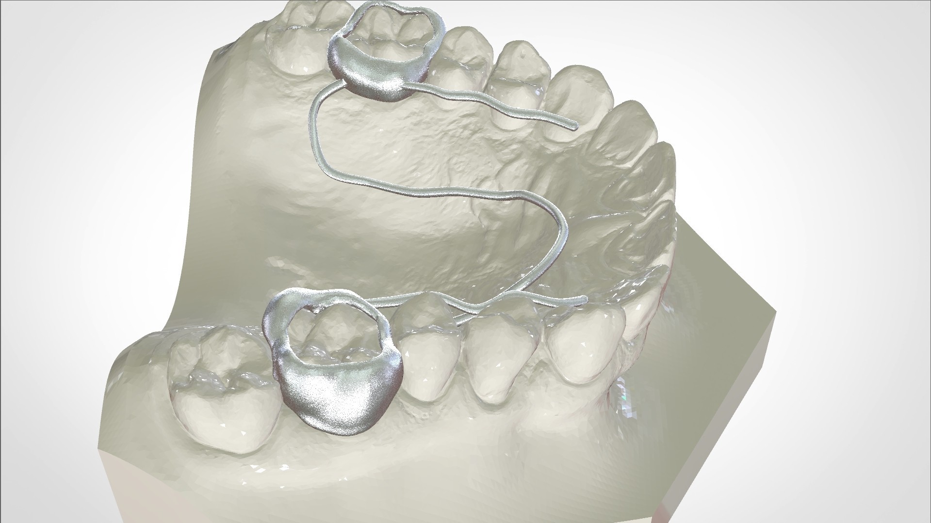 STL file Digital Porter Appliance 🎨 (OBJ and 3MF)・3D printer model to ...