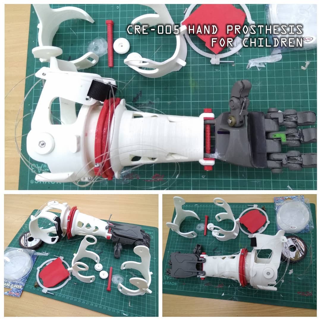 Free STL file CRE-05 Hand Prosthesis for Children ・3D printer model to ...