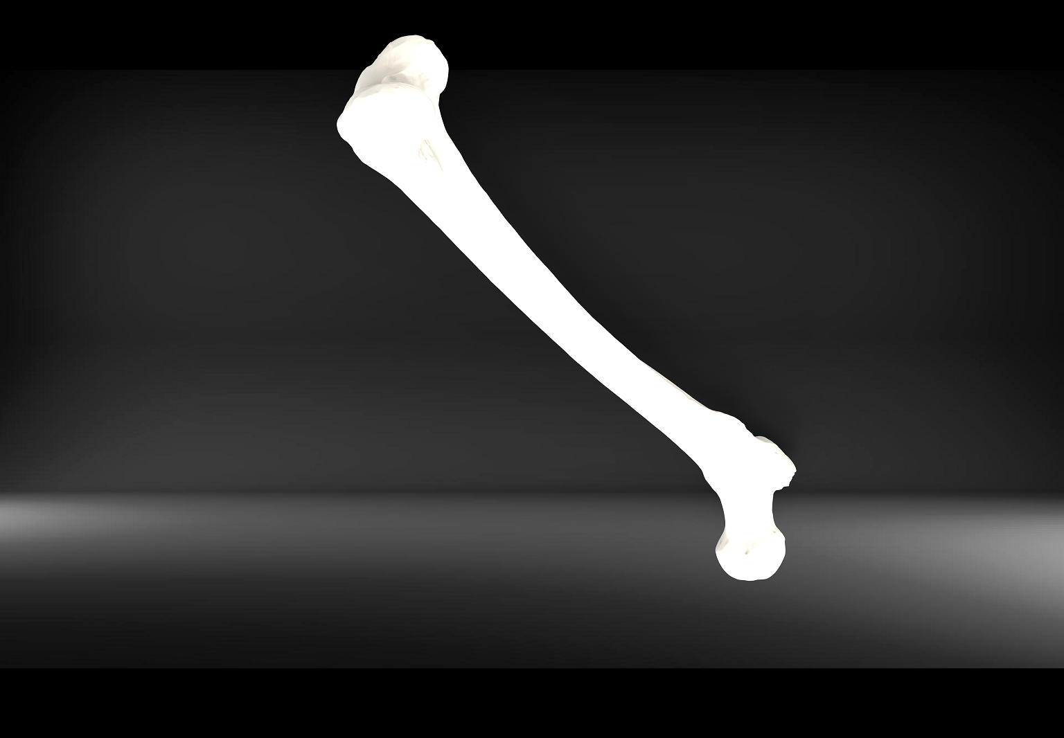 Archivo STL gratuito femur bone / hueso femur 🦴 ・Idea de impresión 3D ...