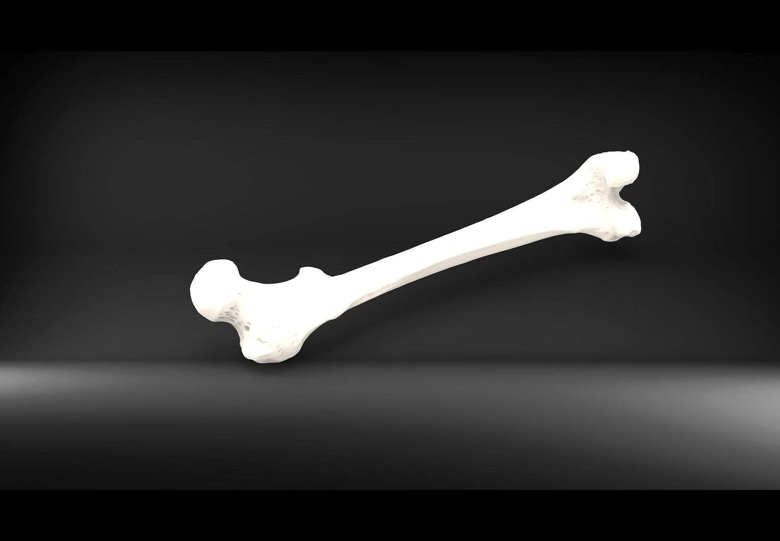 Archivo STL gratuito femur bone / hueso femur 🦴 ・Idea de impresión 3D ...
