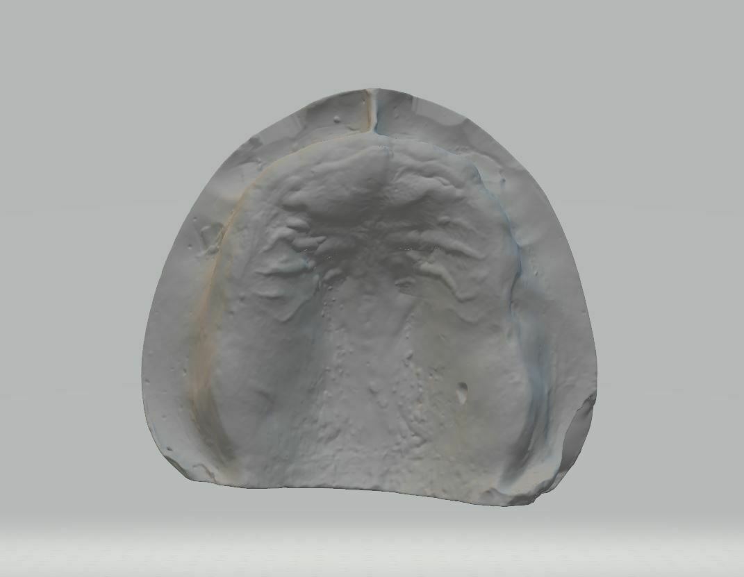 🦷 Totally edentulous maxillary model・ STL File for ・Cults