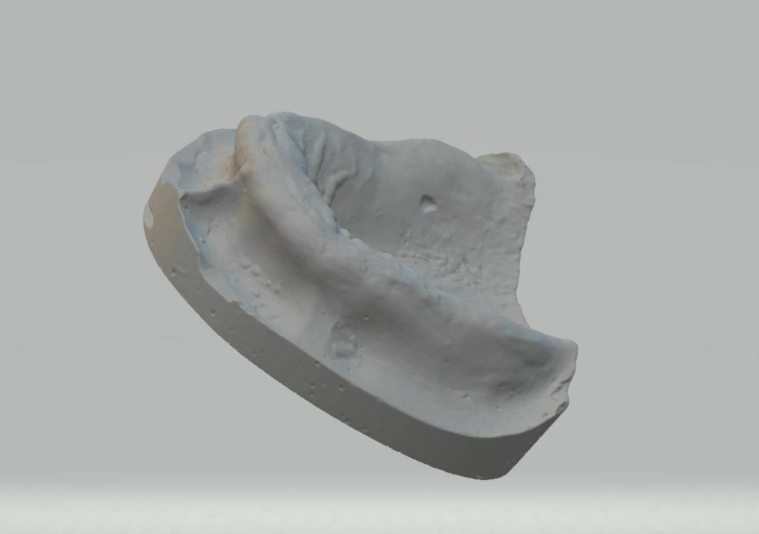 🦷 Totally edentulous maxillary model・ STL File for ・Cults