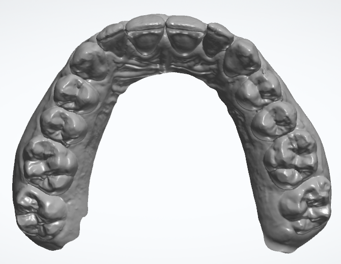 STL file Maxillary Arch 1 🦷・3D print design to download・Cults