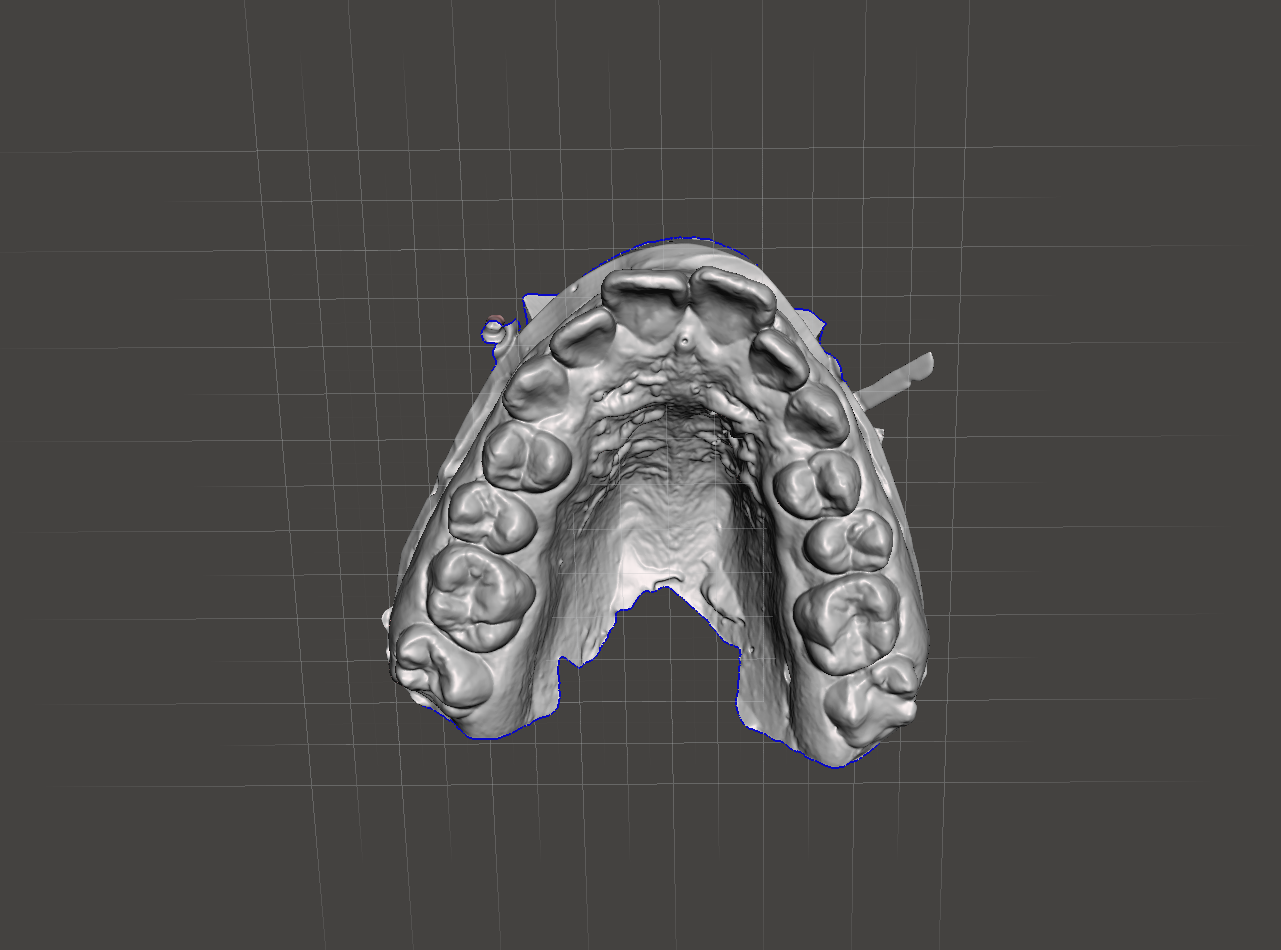 STL file Orthodontics dental model 2 🩻・3D print object to download・Cults