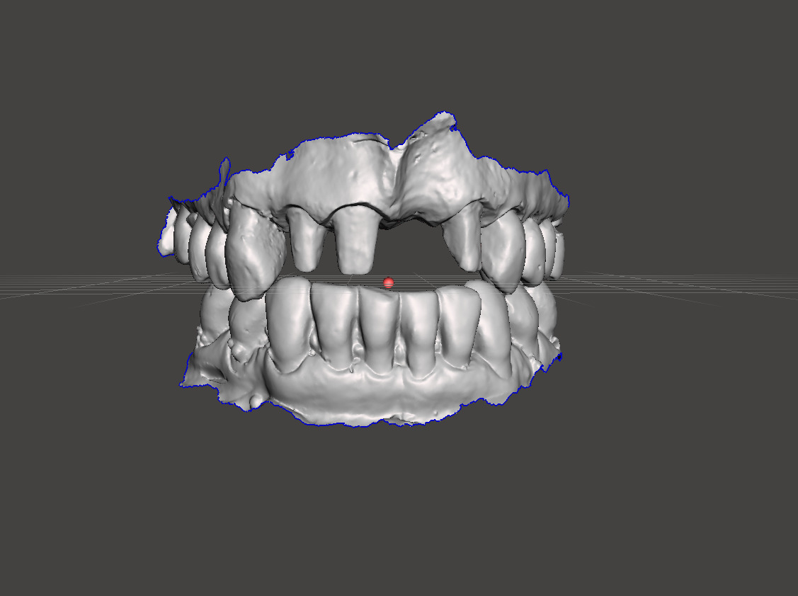 🩻 Dental model case Exocad cad practice #1・ STL File for ・Cults