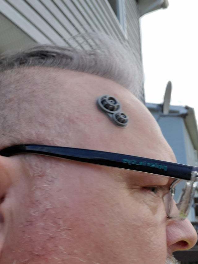 Free STL file Head and Arm Dermal Implants 💪・3D printable object to ...