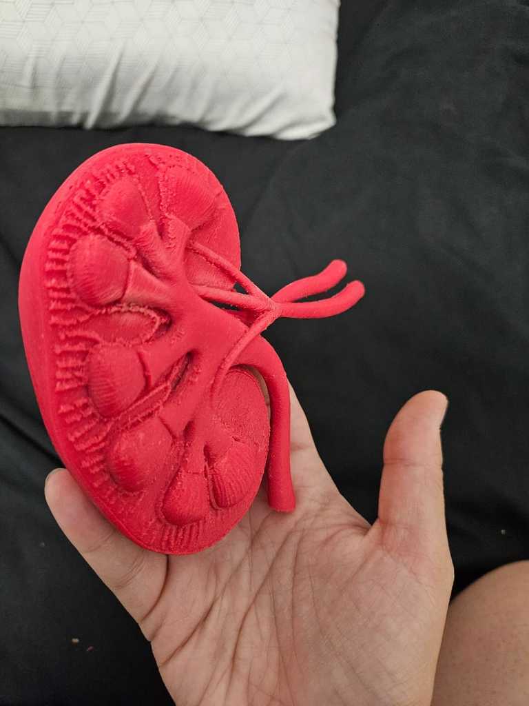 Free 3D file Kidney all together 🧪 ・Model to download and 3D print・Cults