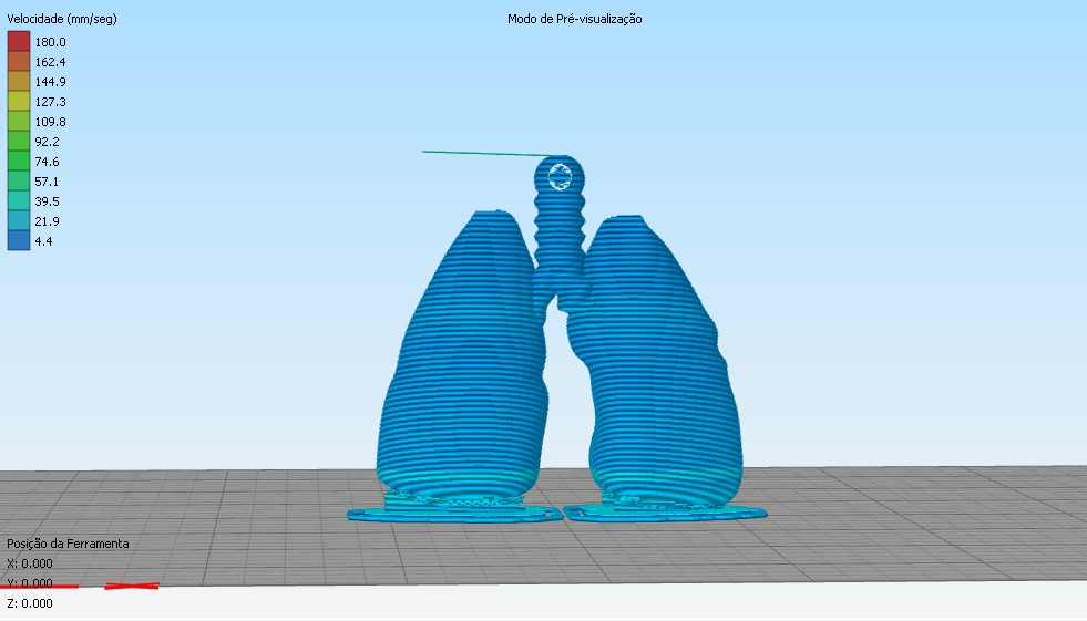 STL file Lung keychain 🗝️ ・3D print design to download・Cults