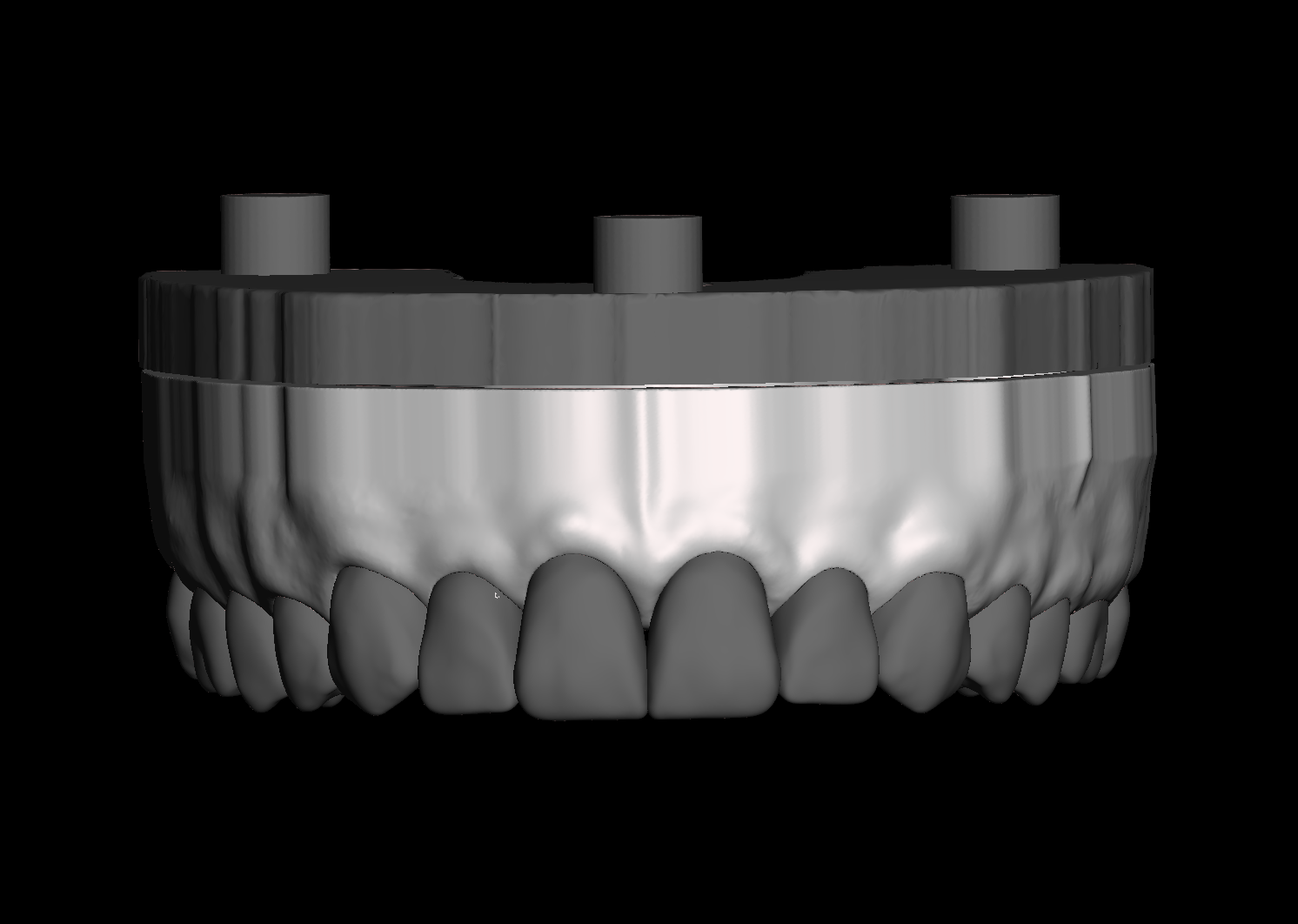 STL file Dental Model with detachable teeth 🦷 ・3D printer design to ...
