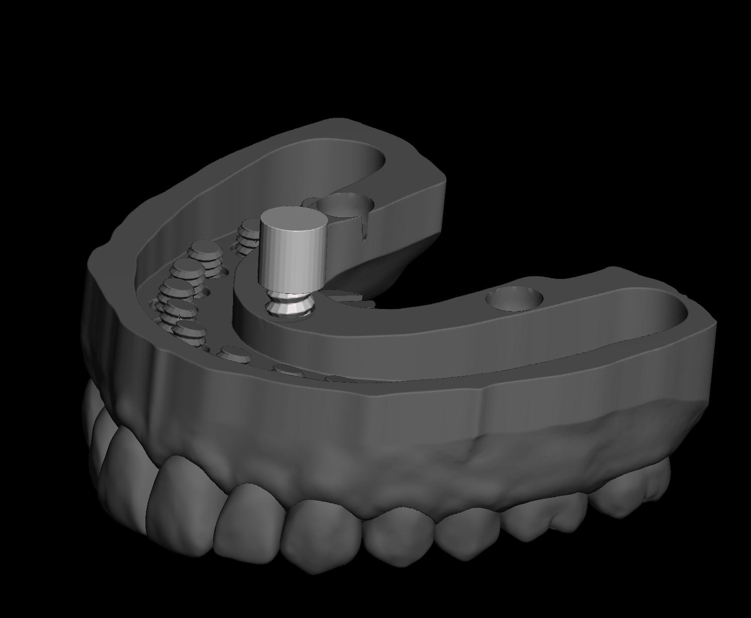 STL file Dental Model with detachable teeth 🦷 ・3D printer design to ...