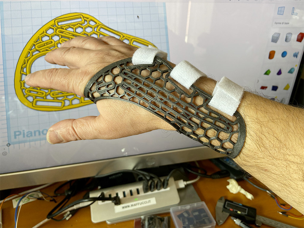 Free 3D file Orthopedic cuff 👽 ・3D printing model to download・Cults