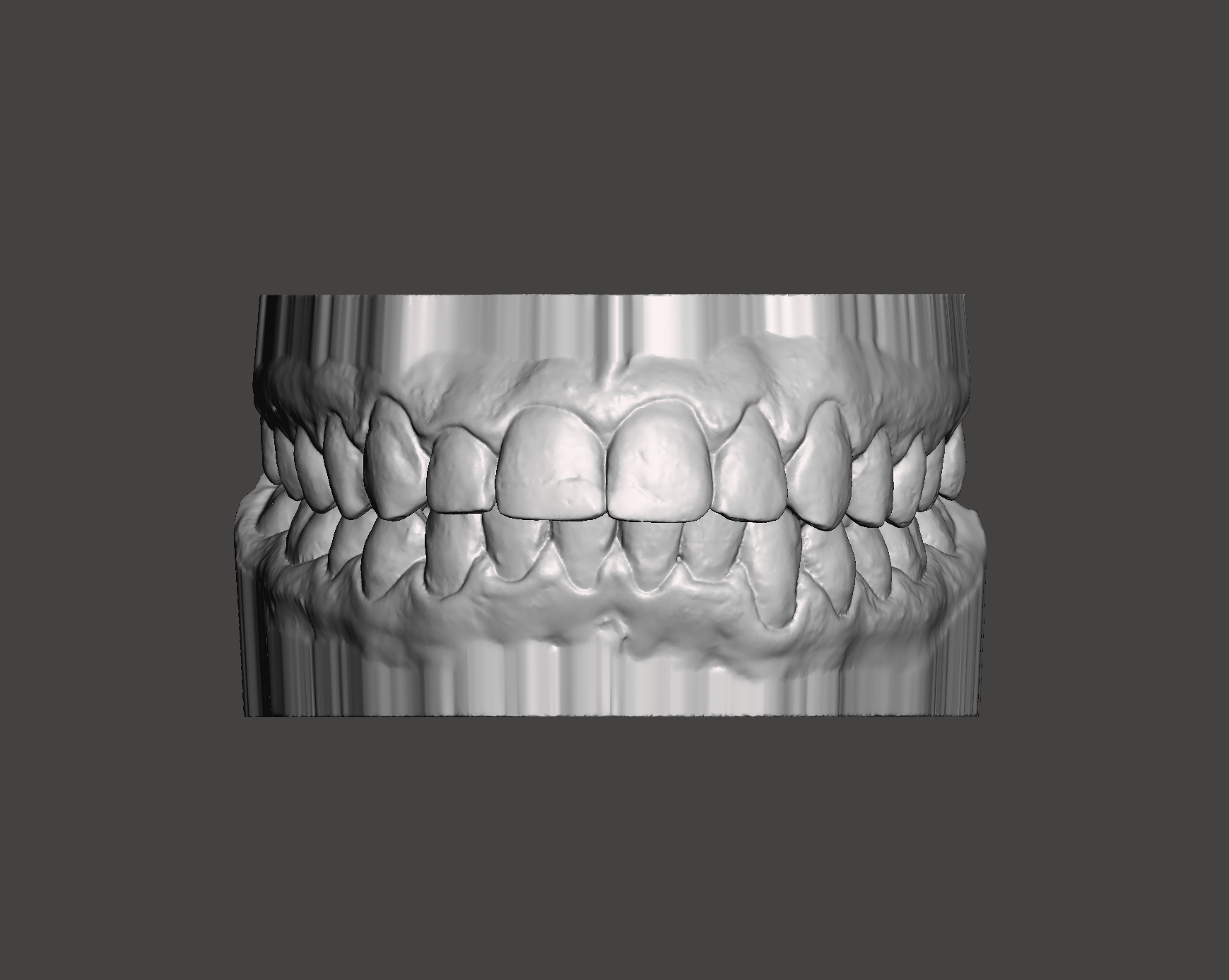 STL file Dental model, mouth, teeth 👄 ・3D printer design to download・Cults
