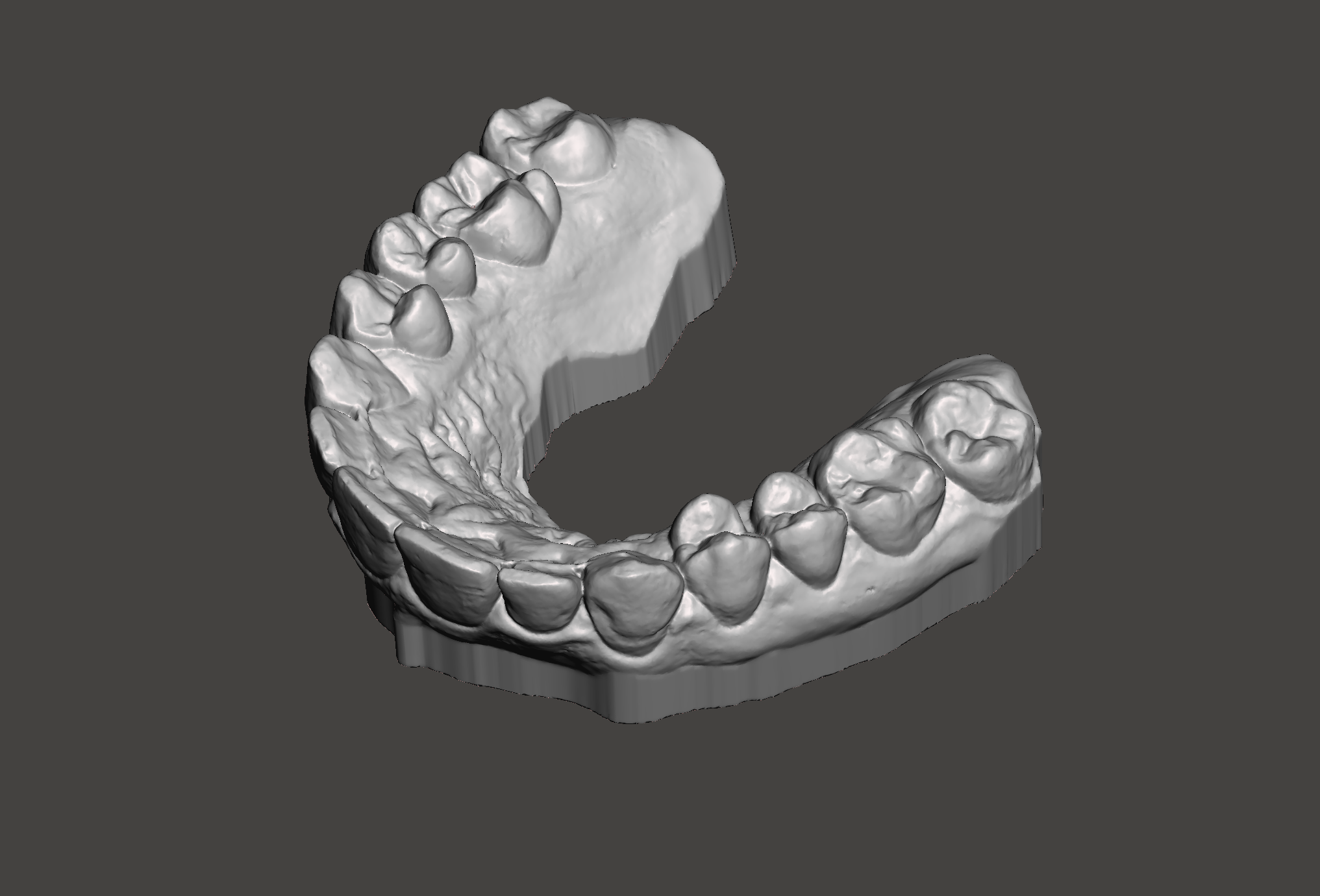 STL file Dental model, mouth, teeth 👄 ・3D printer design to download・Cults