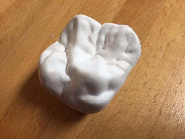 STL file Molar - Tooth 🦷 ・3D print design to download・Cults