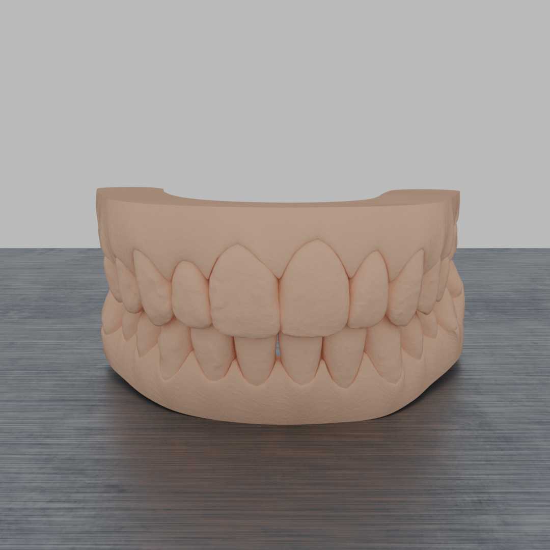 STL file Full Dental model 🦷 ・3D print design to download・Cults