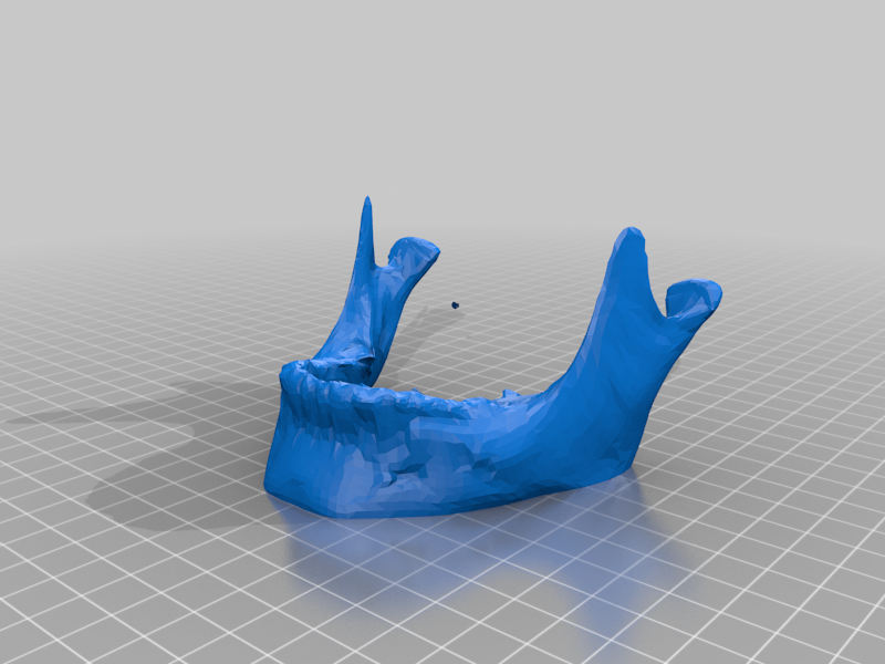 Free STL file IMPLANT 🦷 ・3D printing model to download・Cults