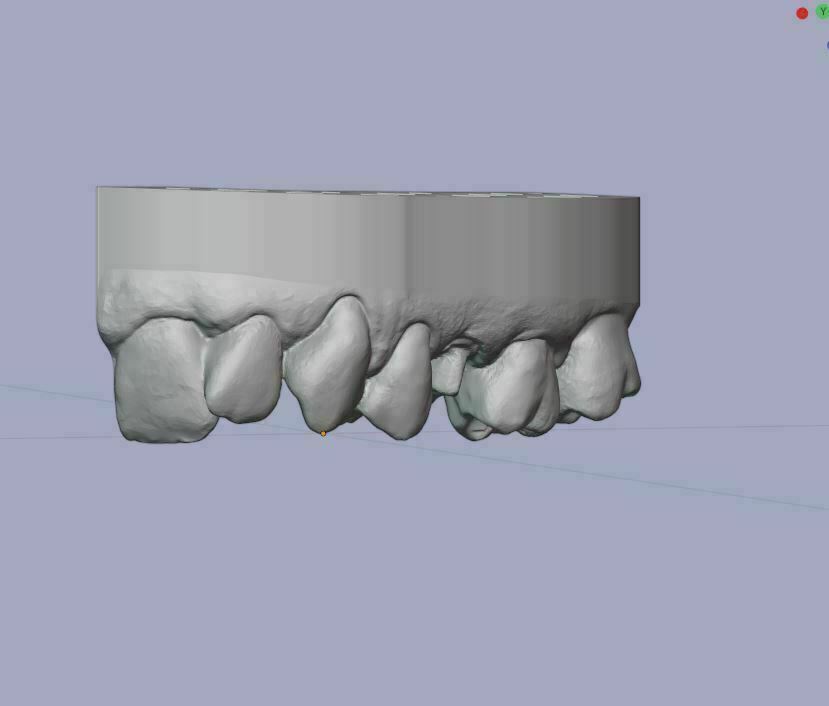 Free STL file Dental Model with Die. Half Arch B4D 🎲 ・3D print model to ...