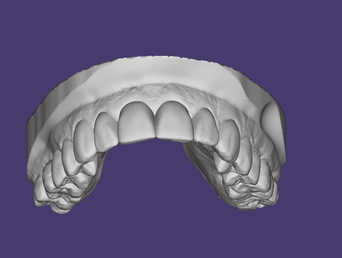 Archivo STL UPPER DENTAL MODEL FOR PRINT MODELO DENTAL SUPERIOR, 🦷 ...