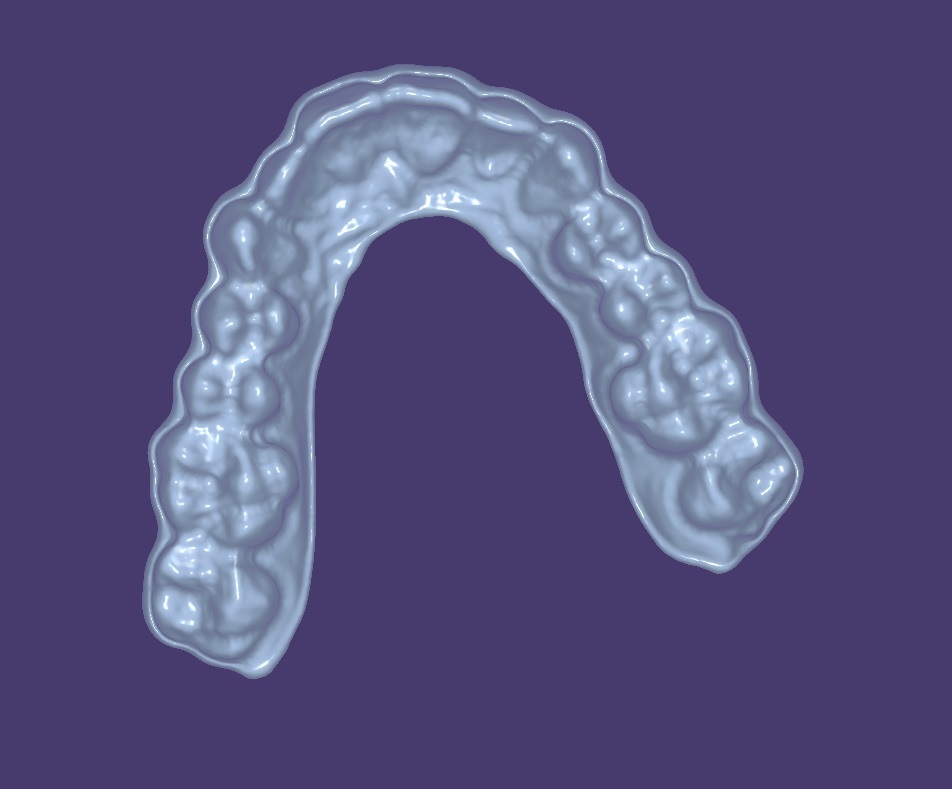 STL file UPPER DENTAL MODEL + BITE SPLINT, UPPER MODEL PLUS REST PLATE ...