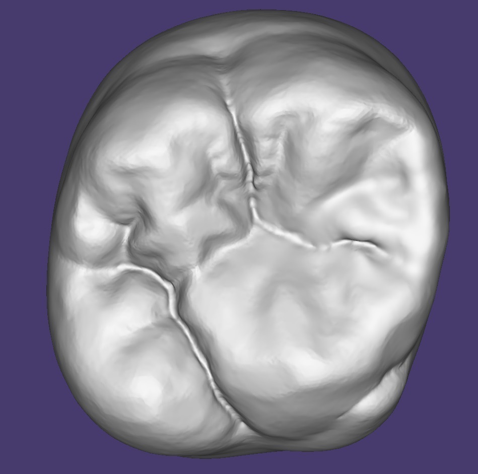 STL file MACROMODEL UPPER MOLAR 16, MACROMODEL UPPER MOLAR 16 🦷 ・3D ...