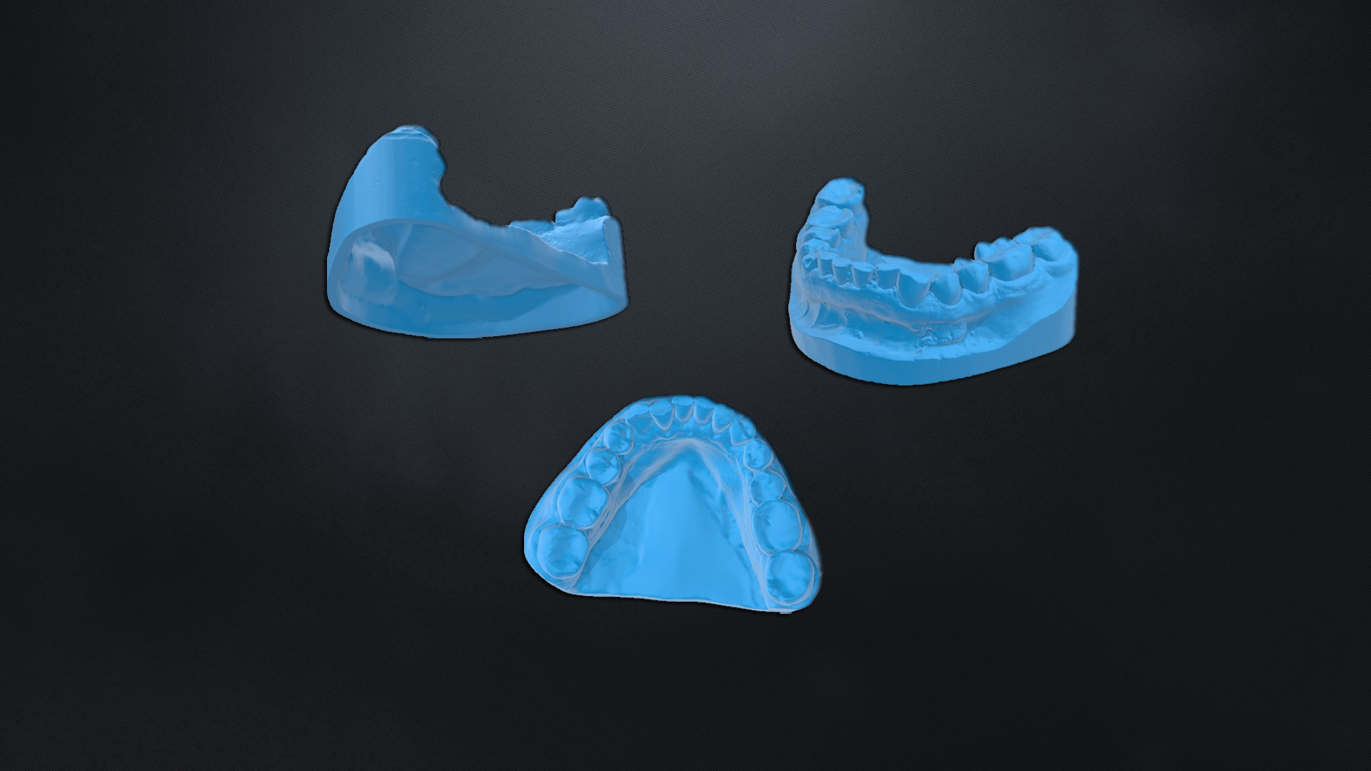 STL file dental model 🦷 ・3D printing model to download・Cults