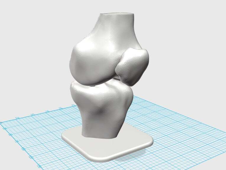 Free STL file Knee from MRI Dicom Data 🩻 ・3D printing model to download ...