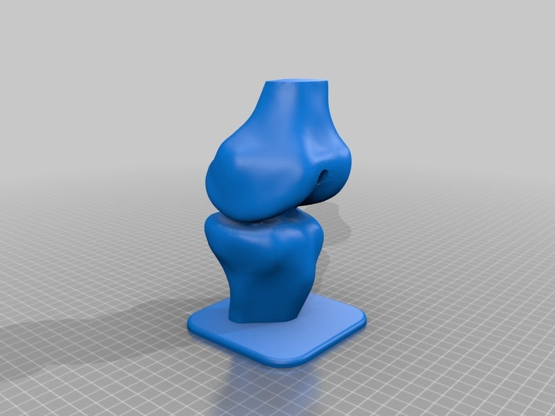 Free STL file Knee from MRI Dicom Data 🩻 ・3D printing model to download ...
