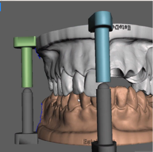 🔧 Dental Articulation Pins・Free STL File for ・Cults