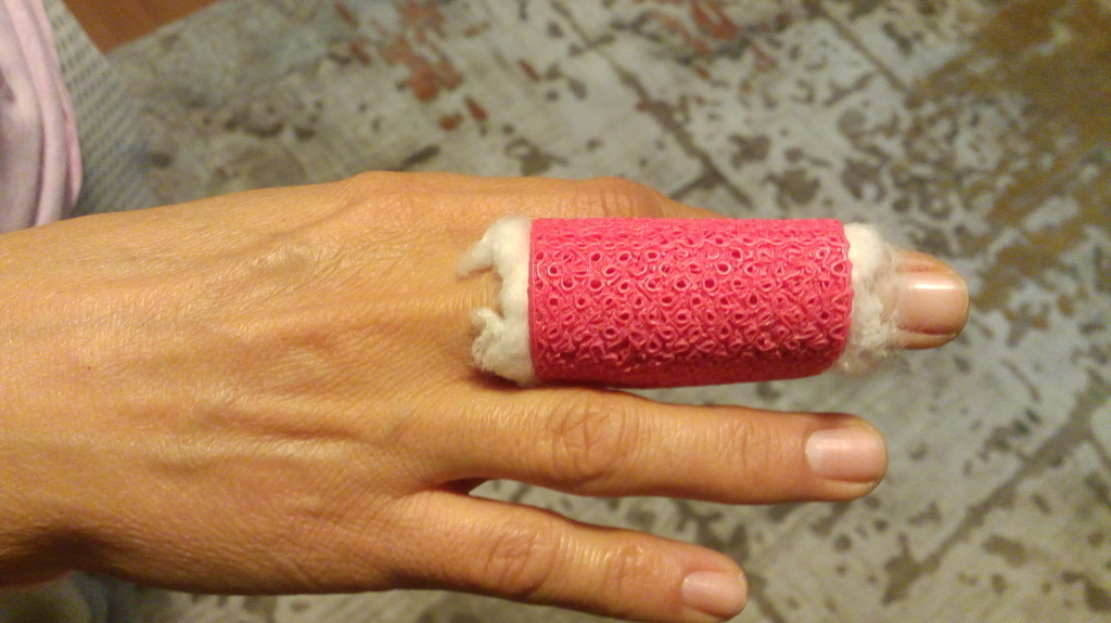 Free STL file finger splints 👽 ・3D printer design to download・Cults